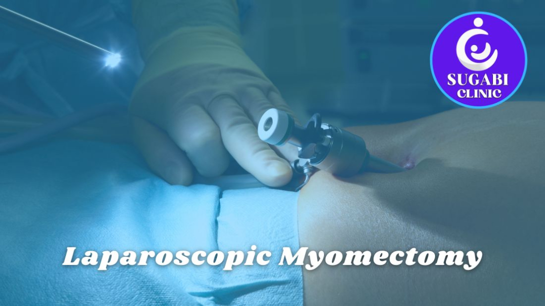 Experience Faster Recovery from Fibroid Surgery: Explore the Advantages of Laparoscopic Myomectomy
